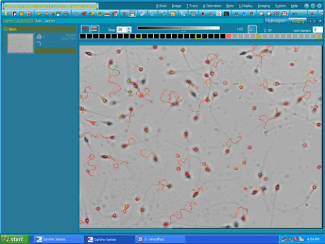 SW-3702 Sperm Quality Analyzer