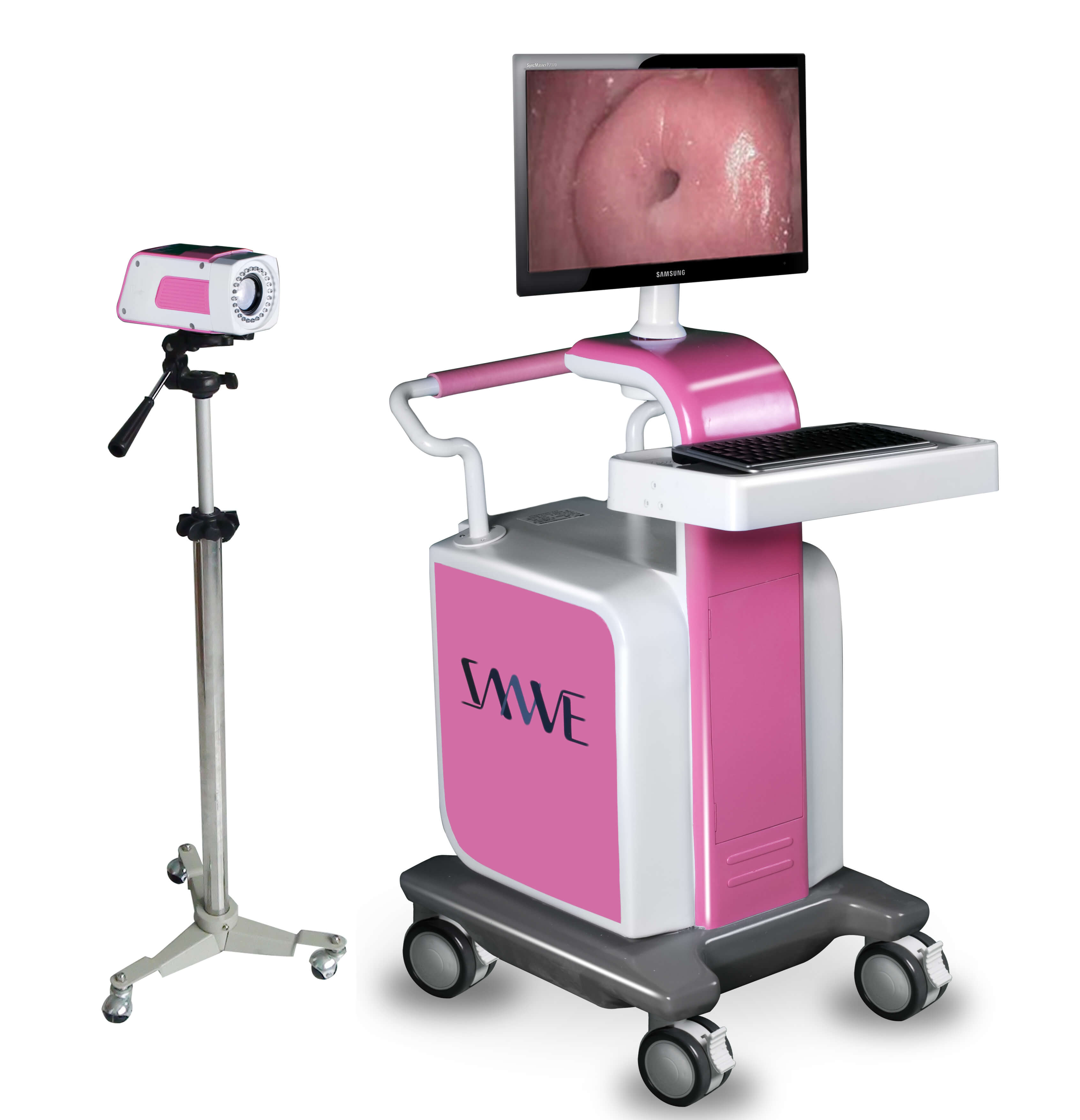 SW-3303 Digital Electronic Colposcope (Trolley-type)
